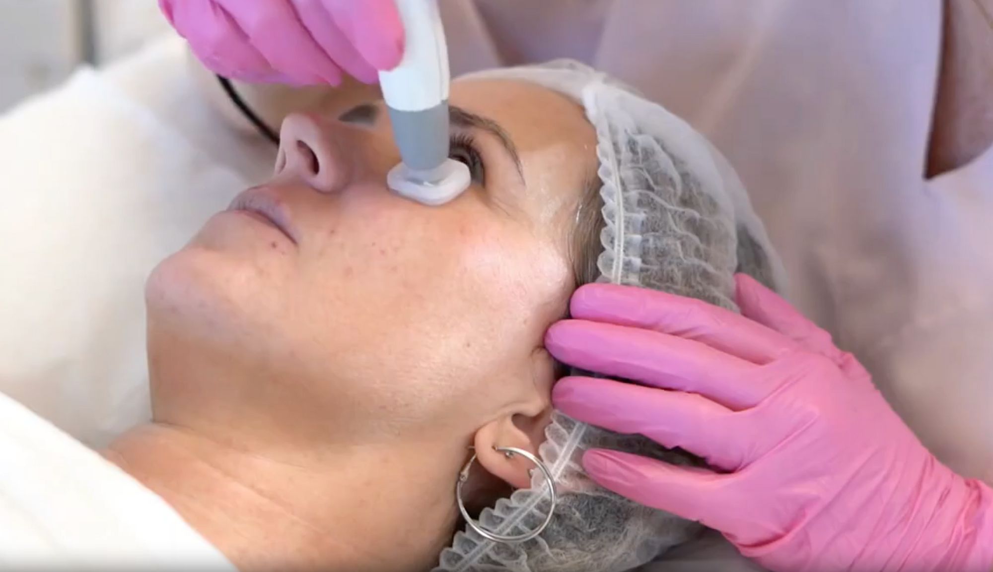 Profosma Jet Plasma – Azura Health and Beauty